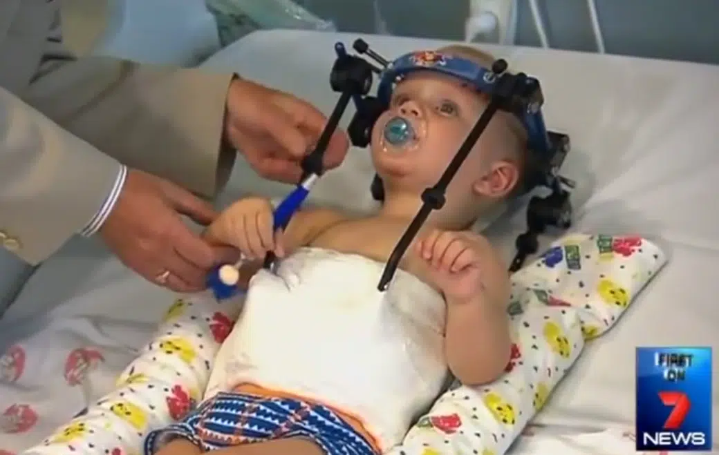 5@5 : Toddler’s Head Reattached After Being Decapitated | 102.9 The Buzz