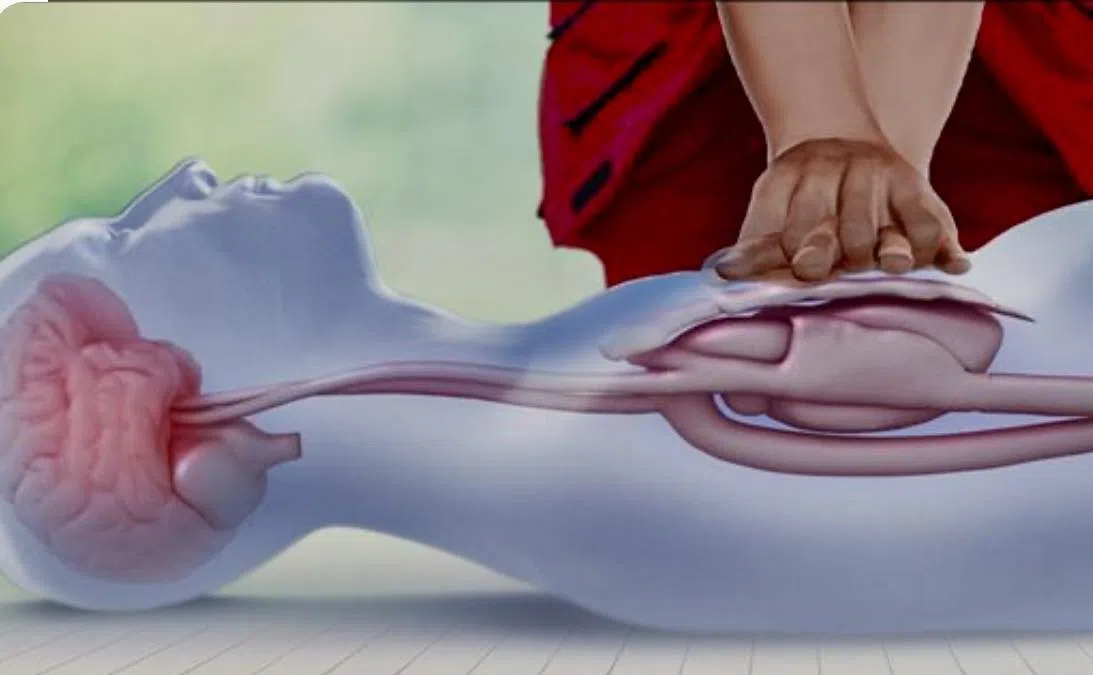 CPR Renewal Class – Thursday, April 17 – 3pm – Metropolis | WMOK