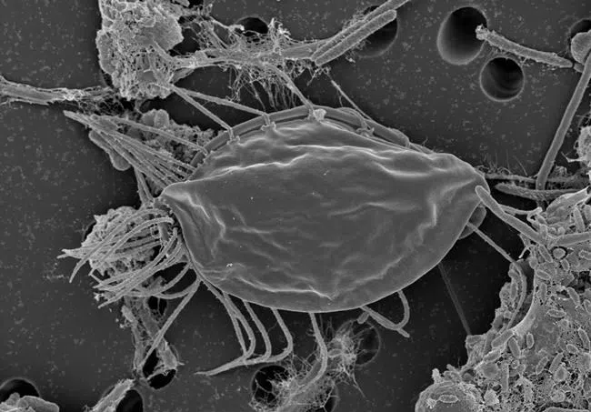 Halifax researchers say microbe reveals ‘major new branch’ of ...